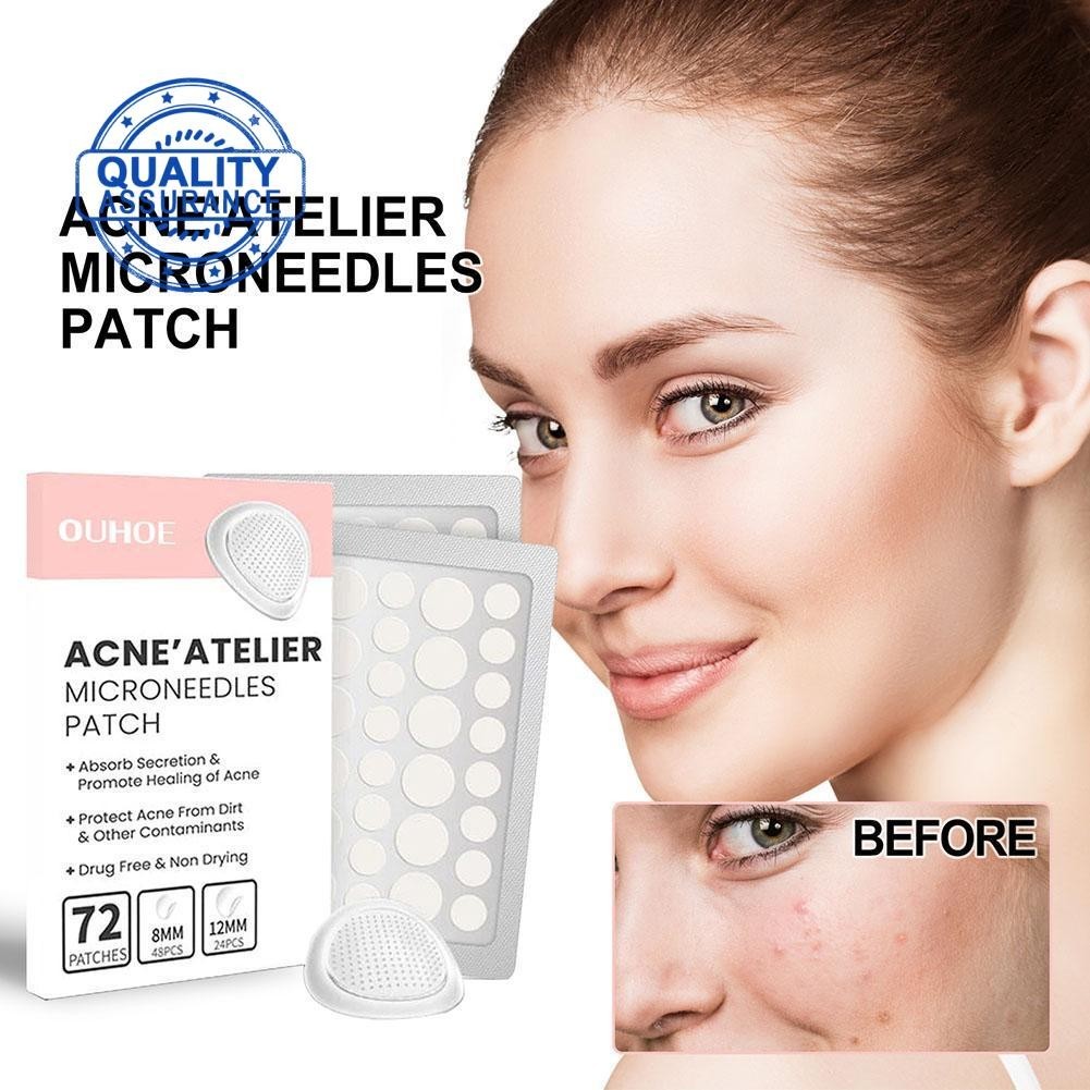 Facial Acne Microneedle Patch Remove Acne With Care | Shopee Malaysia