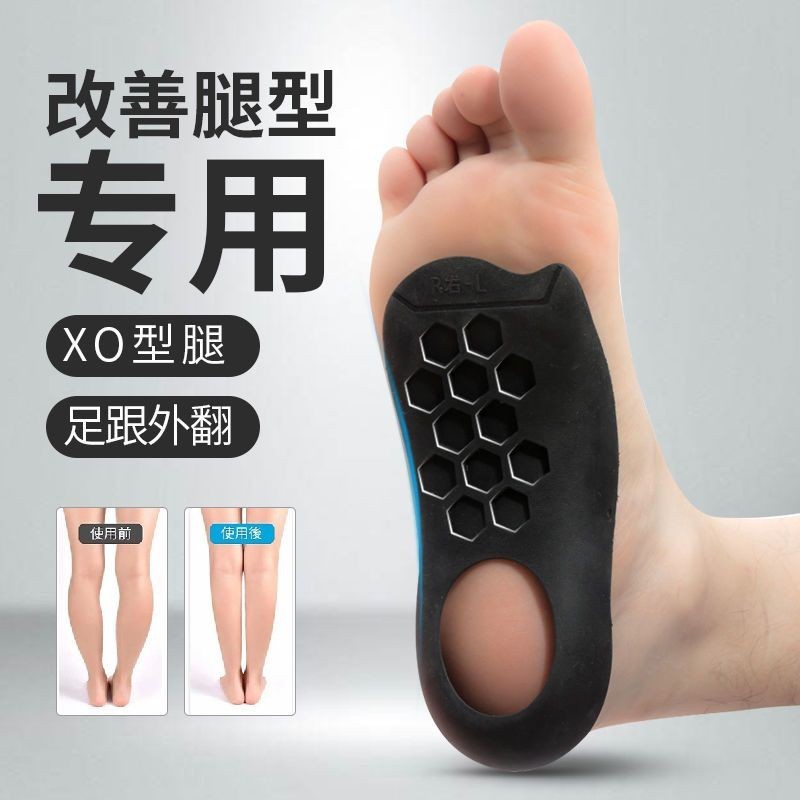 Correct Leg Shape Straight Leg Handy Tool Correct Insole Technology ...