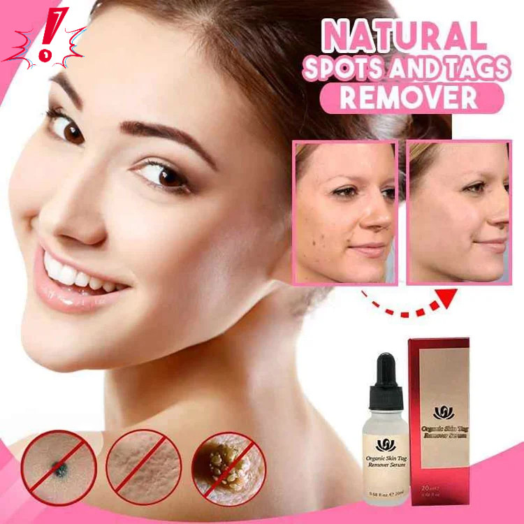 Mole Removal Serum Fade Scars Repair Essential Oil Face Fade Light ...