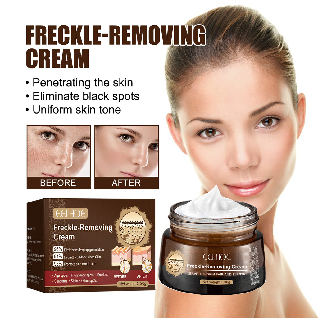 Eelhoe Freckles Cream Moisturizing Moisturizing Fade Freckles Dark ...
