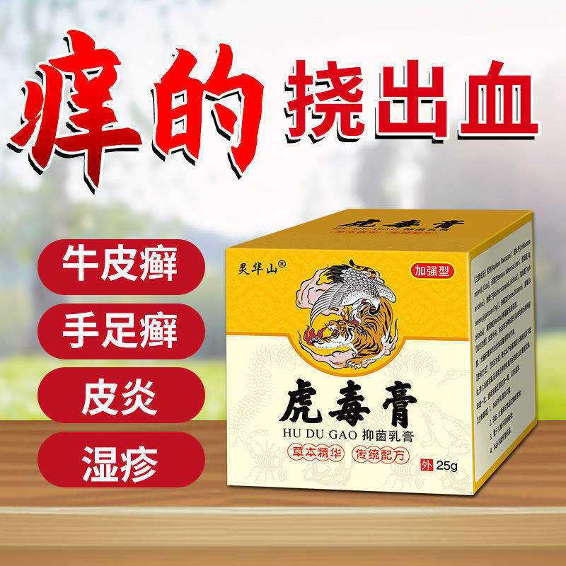 Tiger venom cream for psoriasis, tinea pedis, scalp, ringworm, skin ...