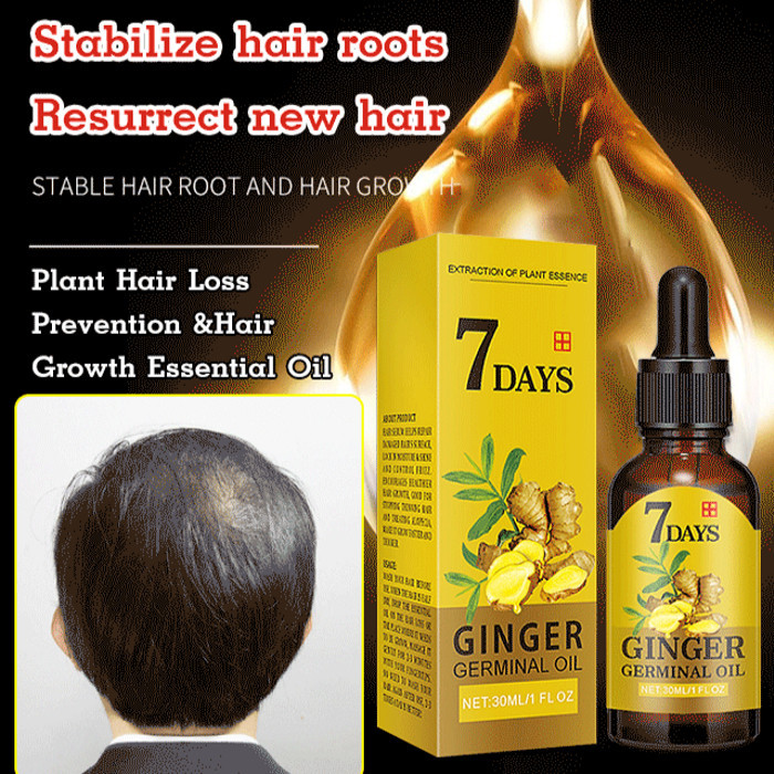 🔥Local Seller🔥Say Goodbye to Hair Loss with Our Ginger Hair Solution ...