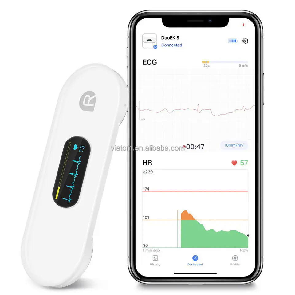 Pocket ECG Monitoring Device with OLED Screen Bluetooth EKG Monitor for ...