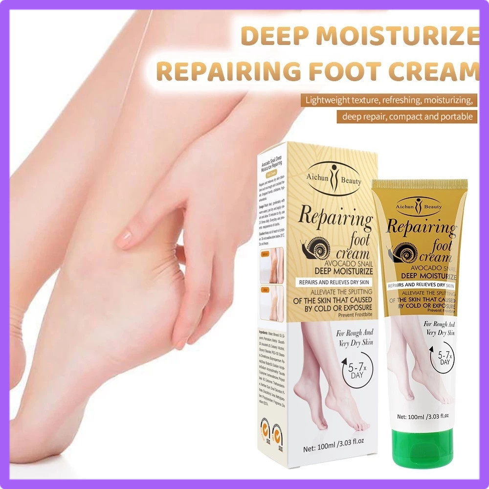 Foot Whitening cream, Soft & Smooth, Anti-Chapped, Dry foot Skin ...