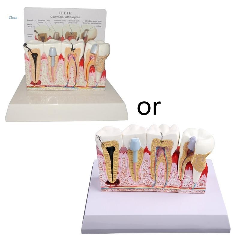 Chua 7x5 9x5 1in Patient Education Explanation Treatment Model for ...