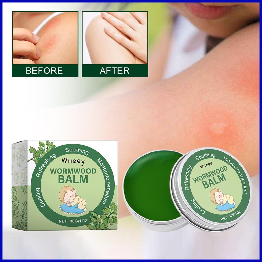 Fly Balm for Kids 30g Bite Relief Soothing Balm Relief Balm from Nature ...
