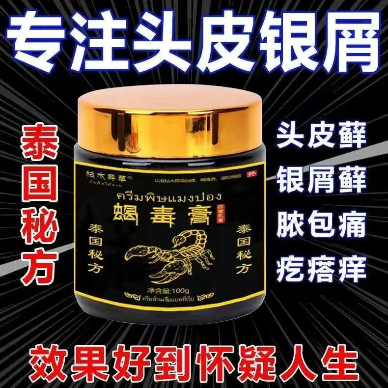Tinea capitis scalp ringworm head psoriasis special effect s Calp ...