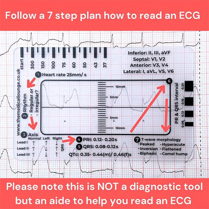 Ecg 7 Step Ruler 7 Step Scale For Ecg Observation Portable Transparent ...