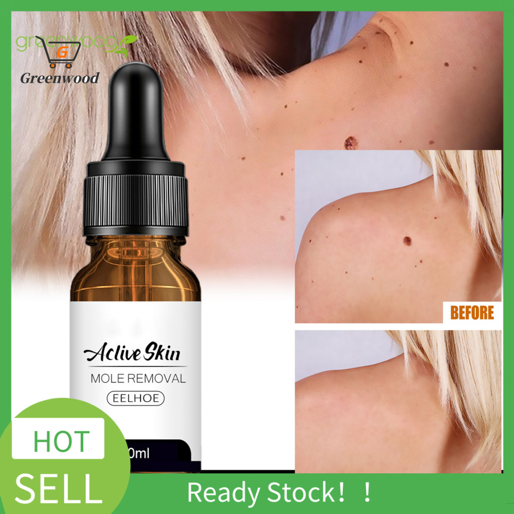 GRE 10ml Wart Removal Liquid Deep Penetration Practical Portable Mole ...