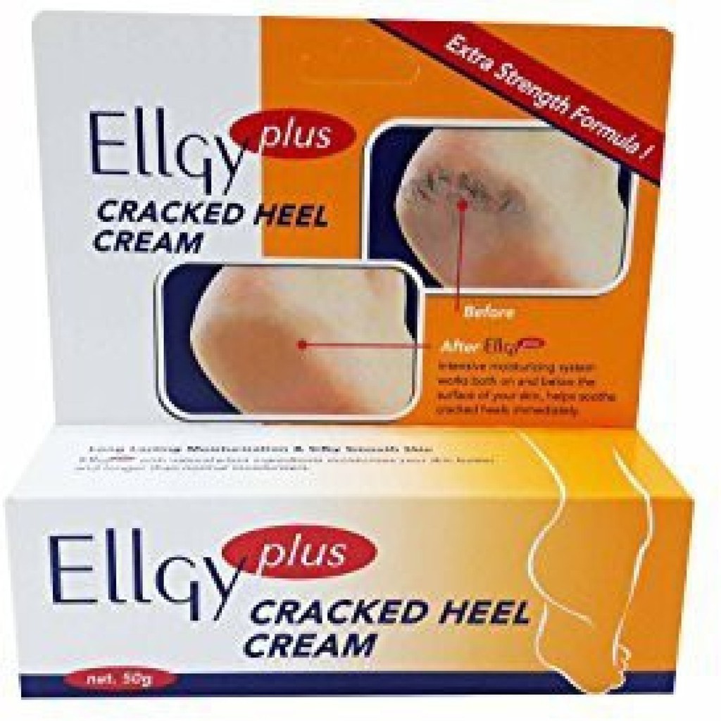 Ellgy Plus Cream (10g / 50g) | Shopee Malaysia