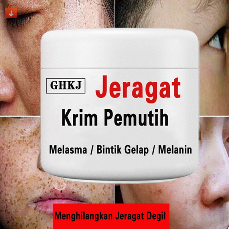 Freckle cream krim jeragat paling berkesan menghilangkan flek hitam ...