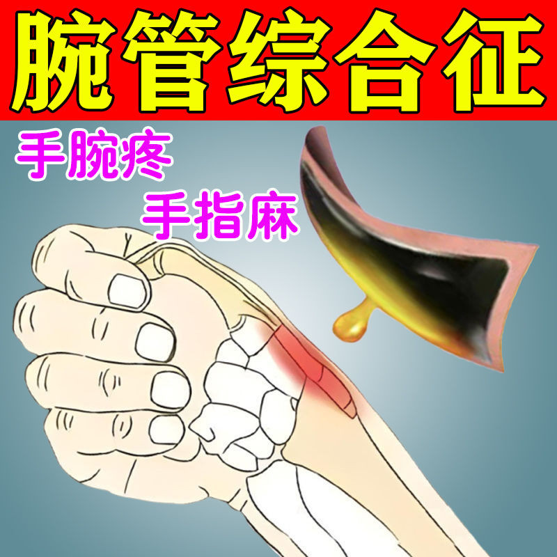 Carpal tunnel syndrome wrist pain finger numb joint pain wrist swelling ...
