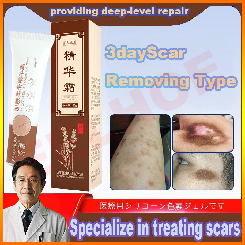 Scar Removal Cream Hyperplasia Scar Repair Cream Treats Acne Marks Post ...