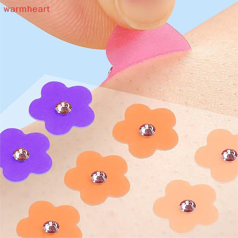 (warmheart) Acne Pimple Patch Sticker Waterproof Acne Treatment Pimple ...