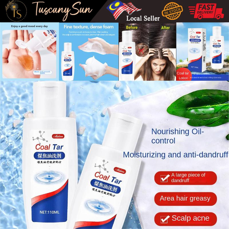 Anti-Dandruff Itching Flaking Scalp Psoriasis Shampoo Coal Tar Lotion Seborrheic Dermatitis Hair ...