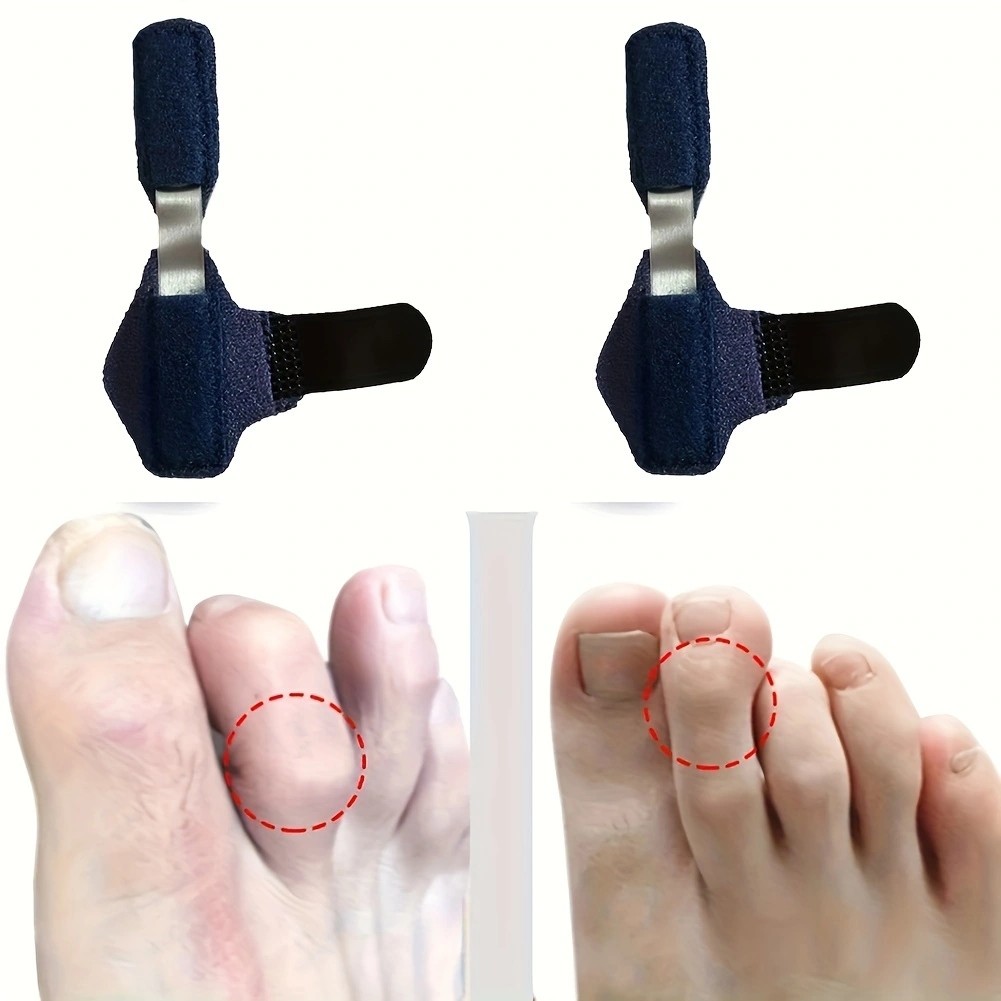 1 PC Blue Feet Care Toe Splint Straightener Fingers Claw Stabilizer ...