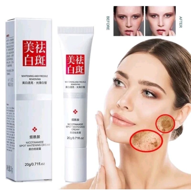 FUYAN Niacinamide Whitening Freckle Removal Cream 20g Fade Melanin ...
