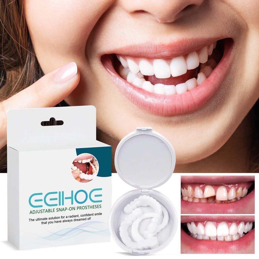Temporary Dentures Adjustable Snap on Denture Temporary Teeth Cover ...