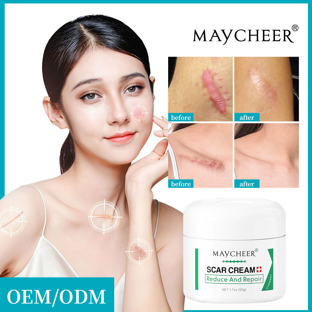 Maycheer Scar Cream Post-Burn Postoperative Fade Scar Skin Ointment ...