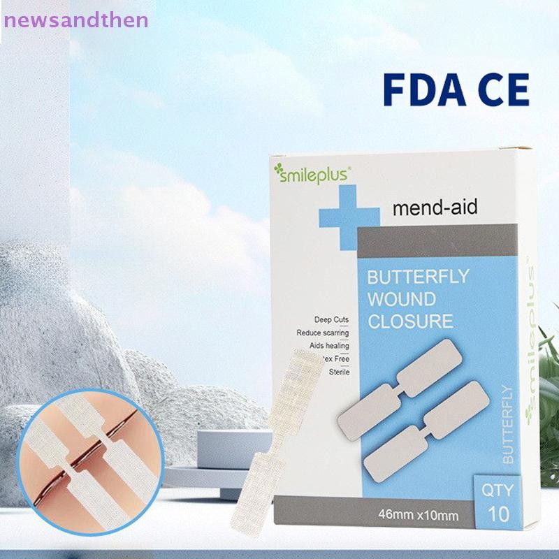 newsandthen 10Pcs Zipper Band-aid Painless Wound Closure Device Suture ...