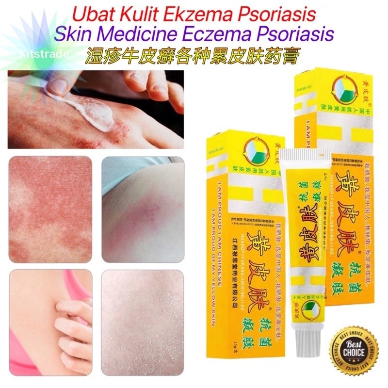 Natural Chinese Herbal Medicine Cream Eczema Psoriasis Antibacterial ...