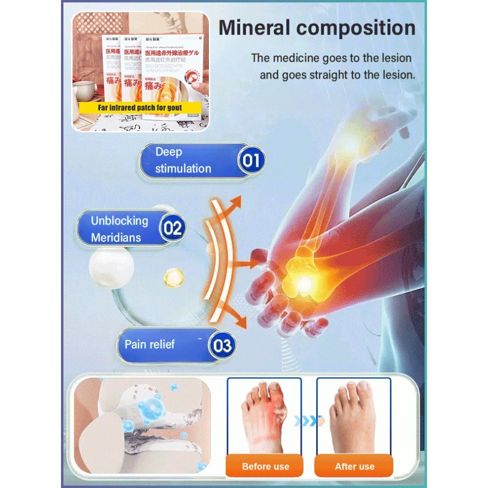 Gout special farinfrared patch for uric acid crystallization | Shopee ...