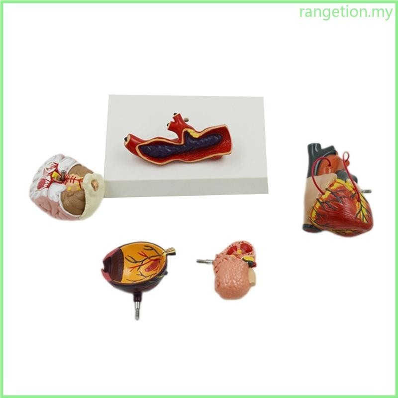 RAN Hypertension Pathology Demonstration Anatomy Model Anatomical Human ...
