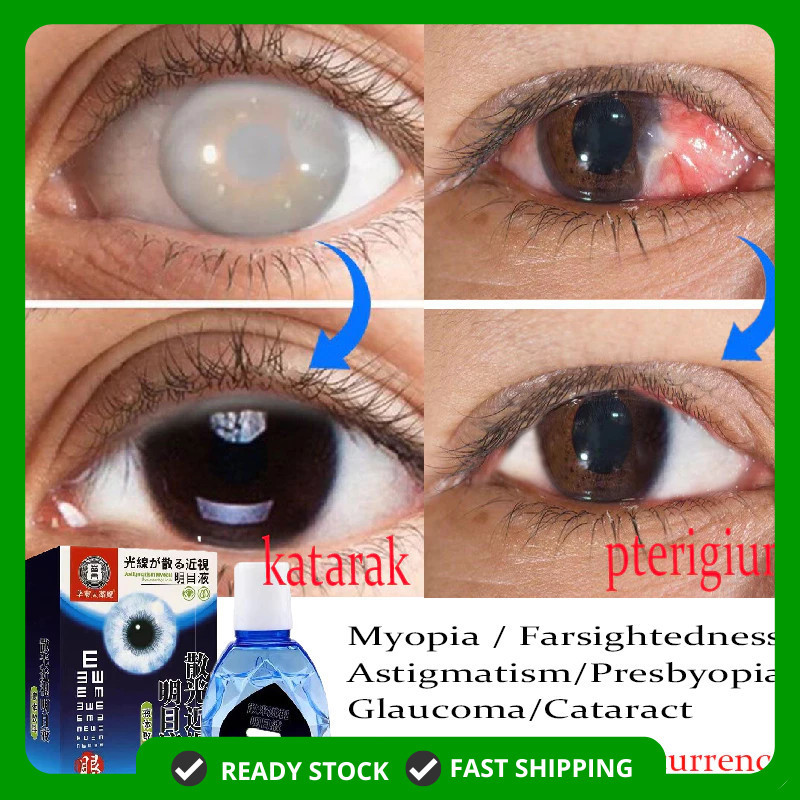 Japan Astigmatism Short-sighted Eye Drops Eye Fatigue Ubat Titis Mata ...