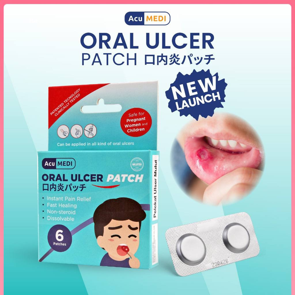 Mouth Ulcer Patch Pelekat Ulcer Mulut AcuMEDI Oral Ulcer Patch for ...