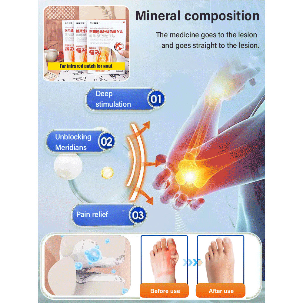 Gout special farinfrared patch for uric acid crystallization | Shopee ...