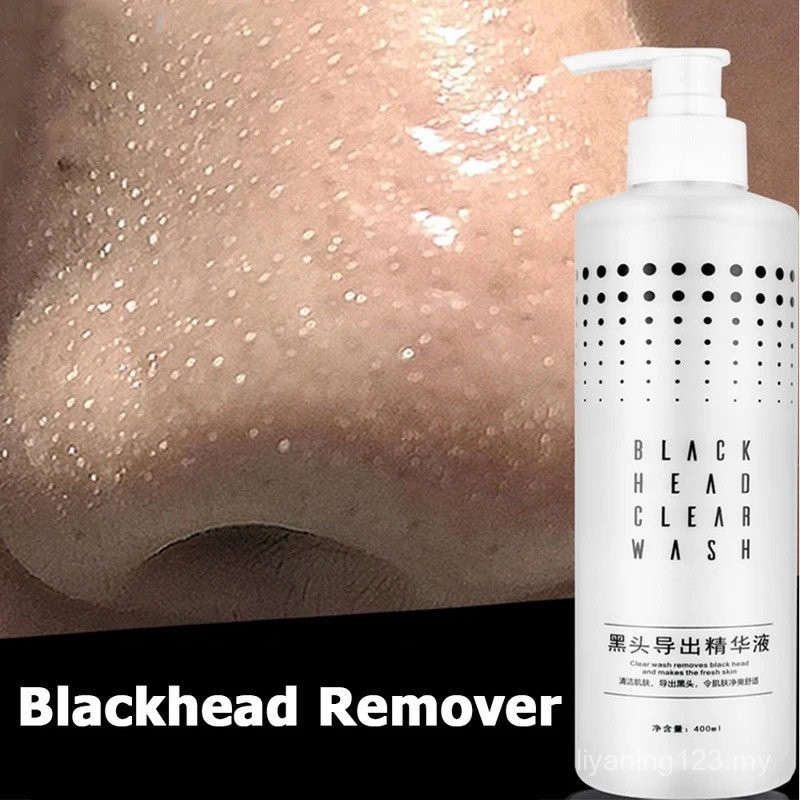 Blackhead Exporting Liquid With Small Bubble Device for Deep Cleansing ...