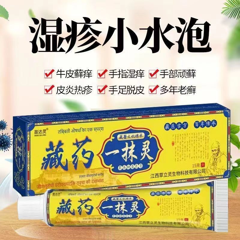 汗泡疹专用手上起小水泡手痒手脚脱皮干裂痒真菌感染一抹灵止痒膏Sweating blisters on the hands, itching ...