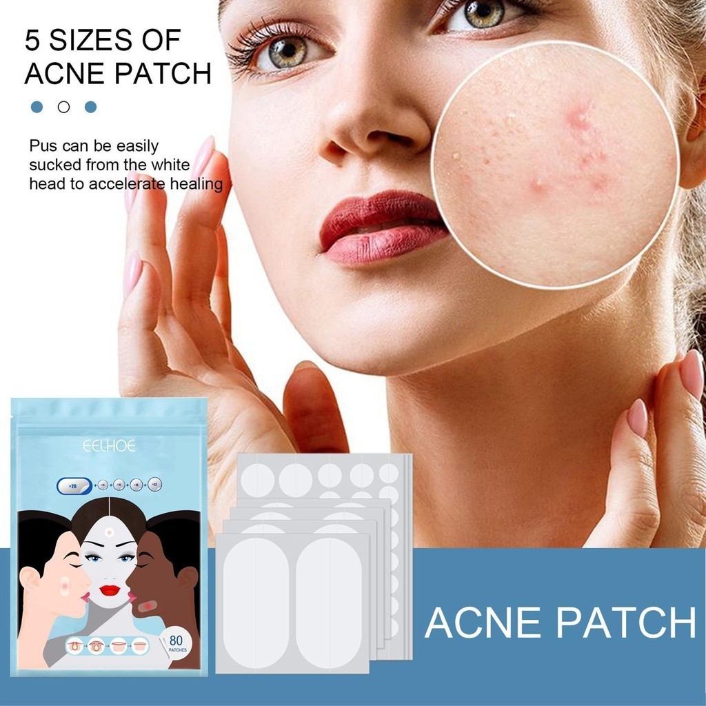 5 Sizes 80Pcs Acnes Removal Pimple Patch Zit Treatment Sticker ...