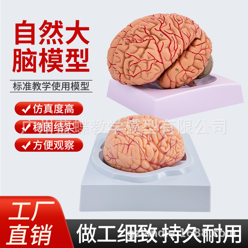 Model Anatomi Otak Manusia 9 Bahagian Anatomi Otak dengan Label Model ...