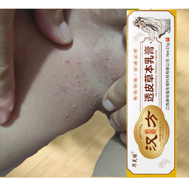 Inner Thighs Red Spots Itching Private Parts Both Sides Goosebumps Red ...