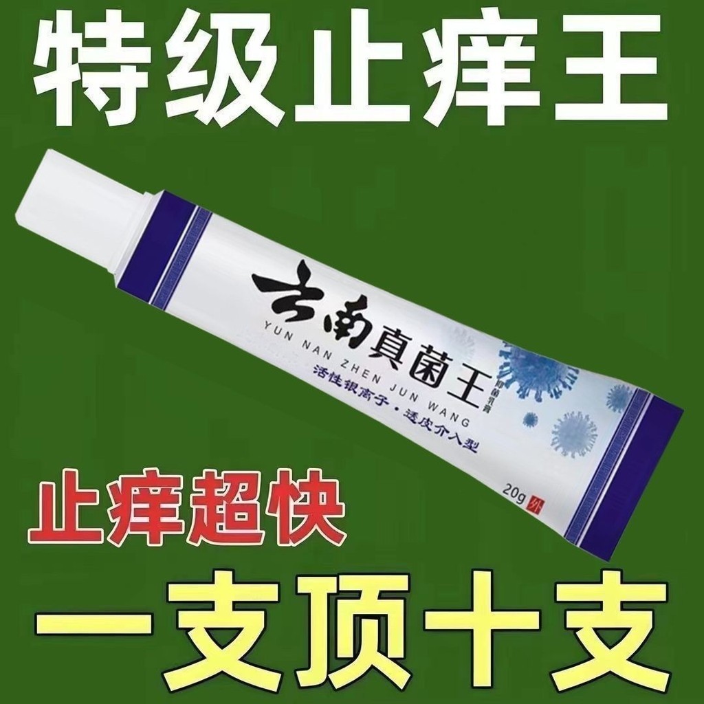 Yunnan Fungi King cream quickly relieves itchi Yunnan Fungi King ...