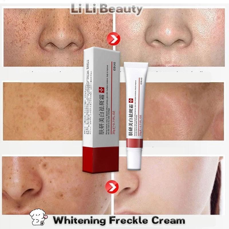 Whitening Freckle Cream 20g Remove Melasma Cream Remove Dark Spots ...