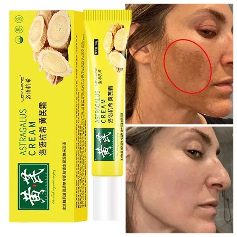 LOYHANC Herbal Astragalus Cream Moisturize Nourish Improve Dull Yellow ...