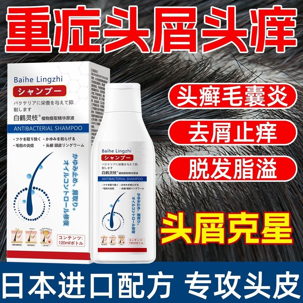 100,000 anti-dandruff, anti-itch, dandruff, scalp, ringworm, 100k anti ...