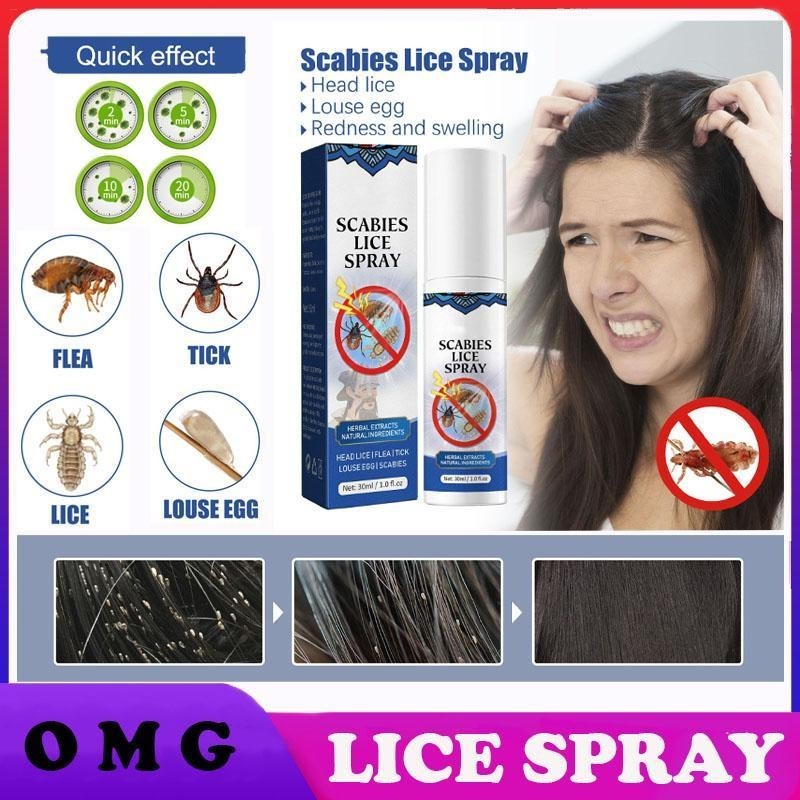 Lice Removal Spray For Kids 30ml Lice Flea Remover Spray Or One Shampoo ...