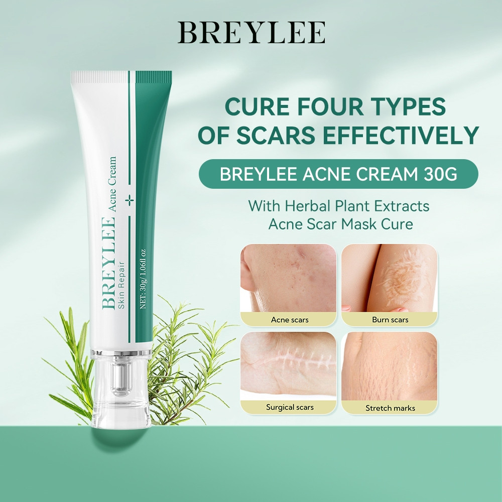 BREYLEE Acne Scar Removal Cream Skin Repair Skin Care Scar Acne Treatment Whitening Cream 30g ...