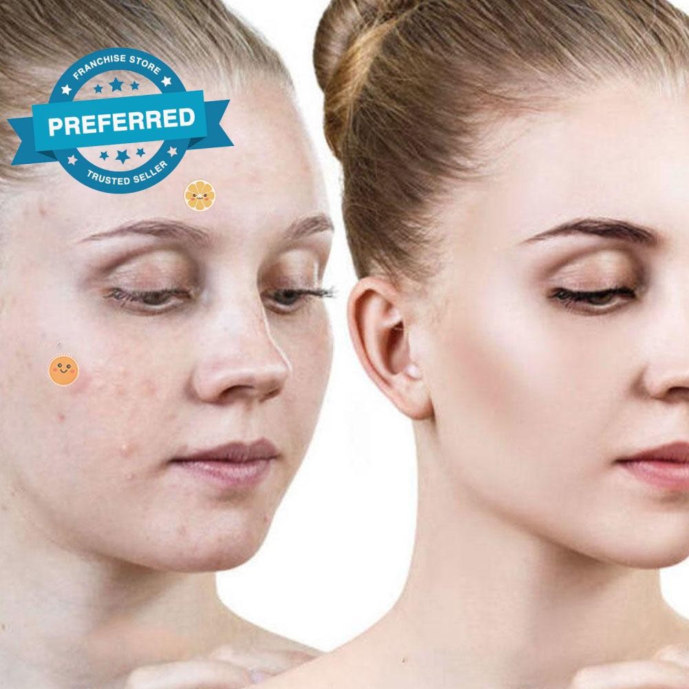 Set Cartoon Acne Patch Hydrocolloid Orange Acne Patches Pimples A5q6 ...