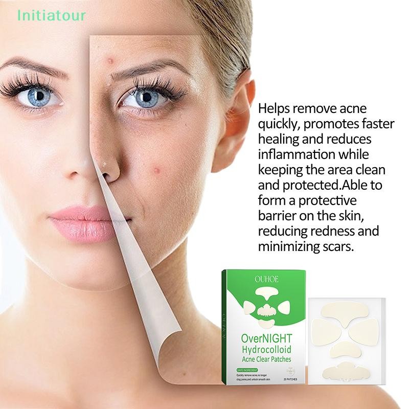 Initiatour Invisible Acne Patches Nose Chin Forehead Cheek Pimples ...