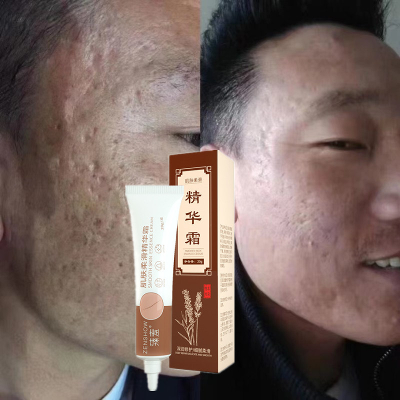 ZHENXIU Skin Smoothing Repairing Cream 20g 肌肤平滑修护精华霜 Repairs stretch ...