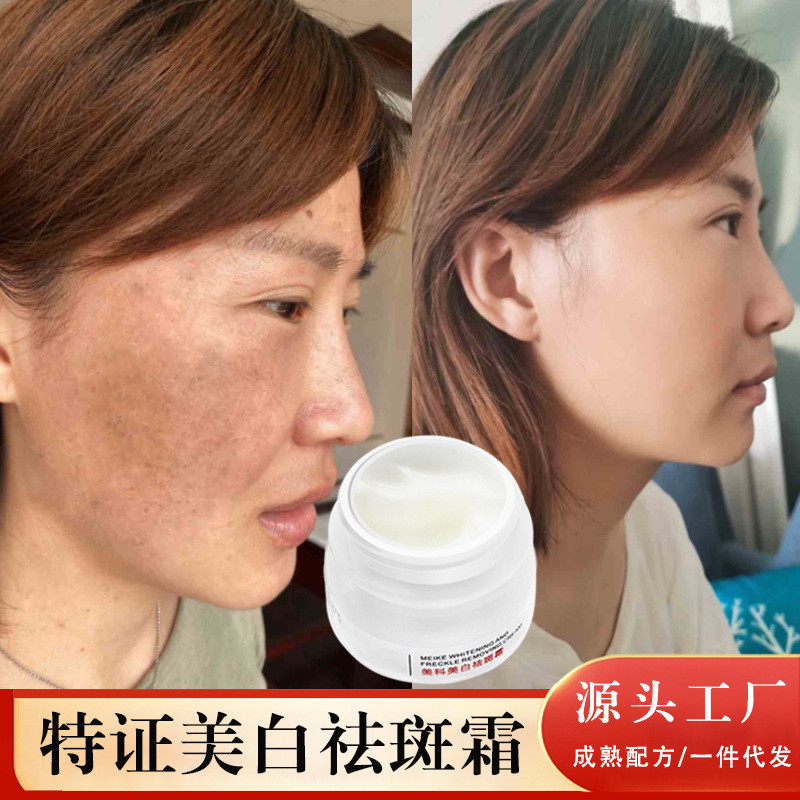 [Ready Stock] Special Certificate Whitening Freckle Removal Cream ...