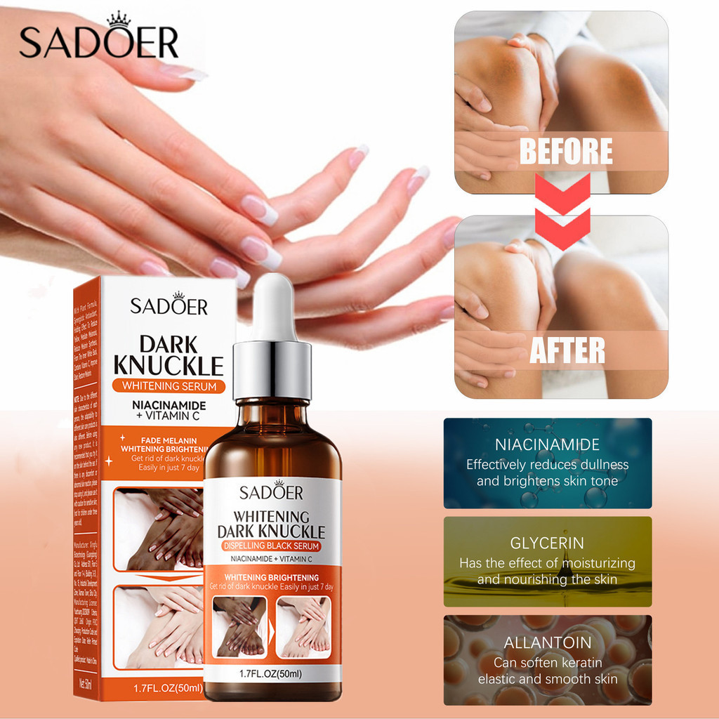 SADOER Dark Knuckle Whitening Serum 50ml Nicotinamide Vitamin C Body Remove Melanin Whitening ...