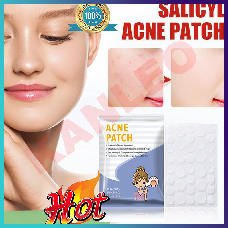 Acne Patch Day Use Night Use Pimple Patch Concealer Waterproof Oil ...