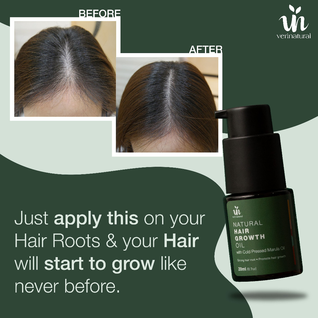 VERI NATURAL 100% Natural - Hair Growth Oil 30ml (Maximize Hair Growth ...
