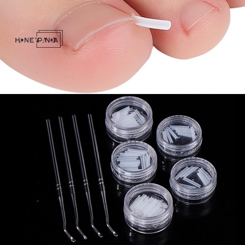 honeypanda Toe Nail Care Hook Ingrown Double Ended Ingrown Toe ...