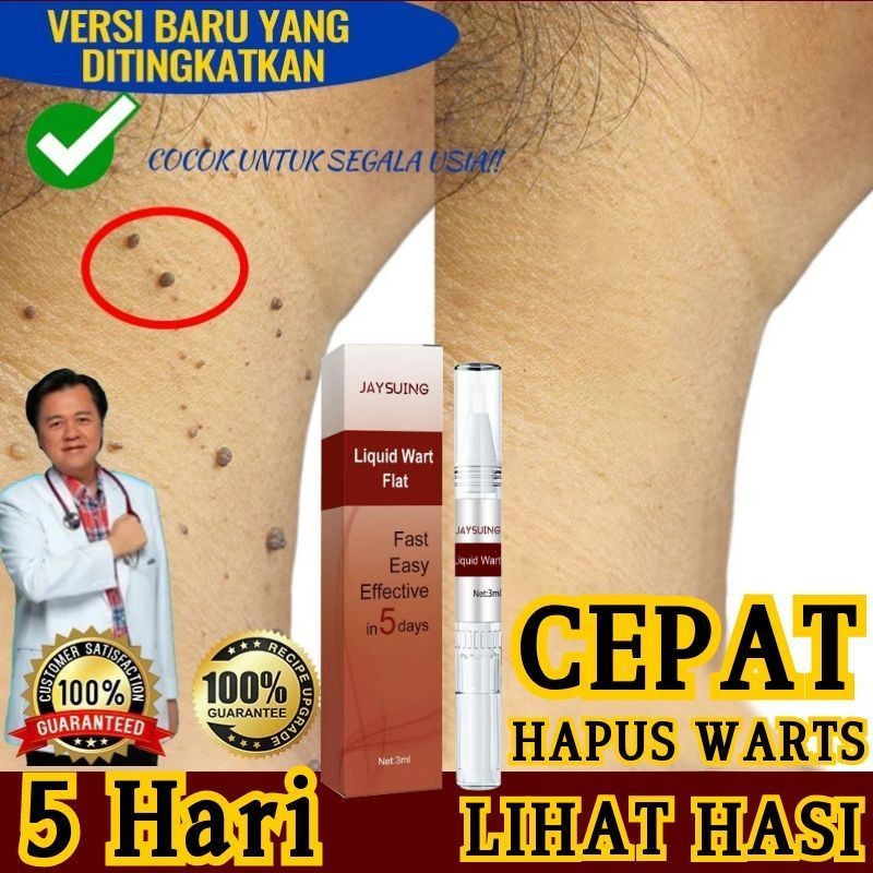 Wart Remover Pen Serum for Face Body Buang Ketuat Dan Tahi Lalat Dengan ...